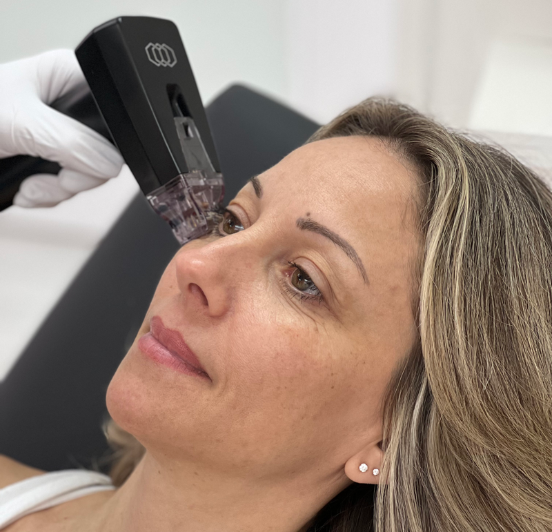 Envision by InMode - Precision Tissue Treatments